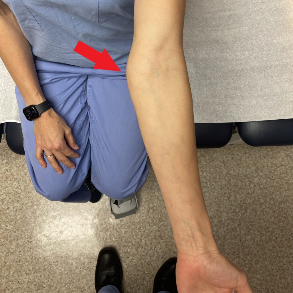 MCL (UCL, Tommy John) Injury – Dr. Edward Weldon