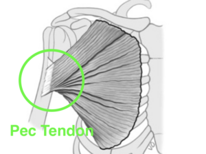 Pectoralis tendon tear – Dr. Edward Weldon